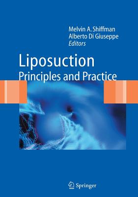 楽天ブックス: Liposuction: Principles and Practice - Melvin a. Shiffman ...