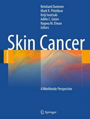 楽天ブックス: Skin Cancer - A World-Wide Perspective - Reinhard Dummer ...