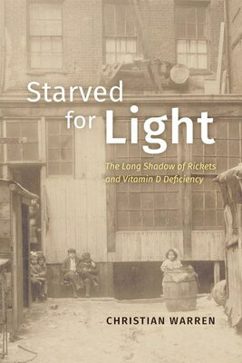 楽天ブックス: Starved for Light: The Long Shadow of Rickets and Vitamin D ...