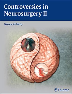 楽天ブックス: Controversies in Neurosurgery II - Ossama Al-Mefty ...