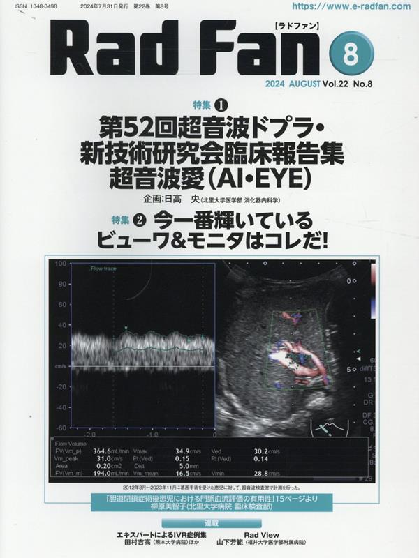 楽天ブックス: Rad Fan（2024 AUGUST（Vol） - 9784862912879 : 本