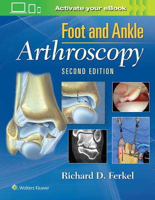 楽天ブックス: Foot & Ankle Arthroscopy - Richard D. Ferkel - 9780781783415 : 洋書