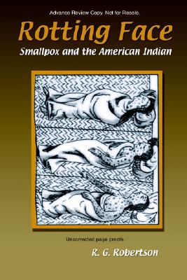 楽天ブックス: Rotting Face: Smallpox and the American Indian - R. G ...