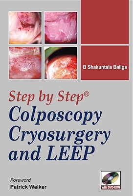 楽天ブックス: Step-By-Step Colposcopy, Cryosurgery, and Leep - Baliga B ...