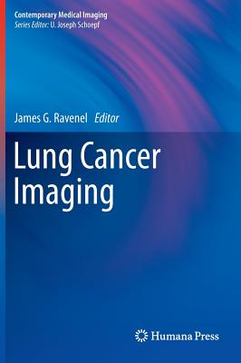 楽天ブックス: Lung Cancer Imaging - James G. Ravenel - 9781607616191 : 洋書