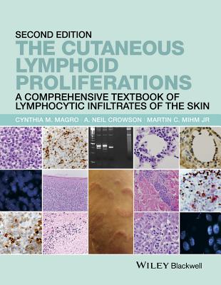 楽天ブックス: The Cutaneous Lymphoid Proliferations: A Comprehensive Textbook ...
