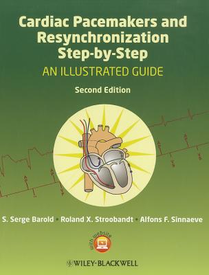 楽天ブックス: Cardiac Pacemakers and Resynchronization Step by Step: An ...