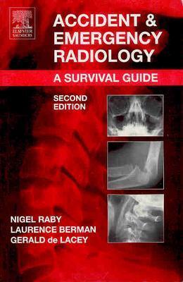 楽天ブックス: Accident and Emergency Radiology - Nigel Raby - 9780702026676 : 洋書