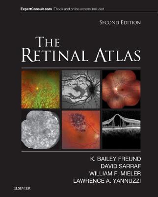 楽天ブックス: The Retinal Atlas - K. Bailey Freund - 9780323287920 : 洋書