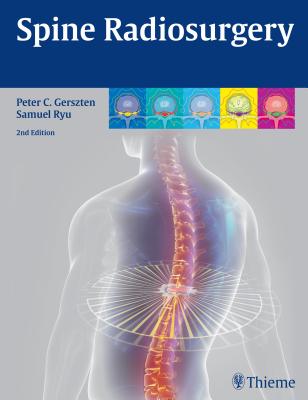 楽天ブックス: Controversies in Stereotactic Radiosurgery: Best Evidence ...