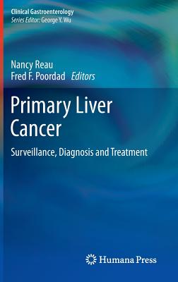 楽天ブックス: Primary Liver Cancer: Surveillance, Diagnosis and Treatment ...