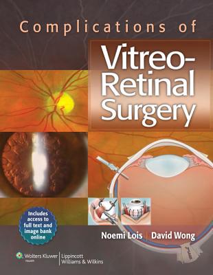 楽天ブックス: Complications of Vitreo-Retinal Surgery with Access Code ...