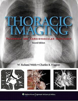 楽天ブックス: Thoracic Imaging: Pulmonary and Cardiovascular Radiology [With ...