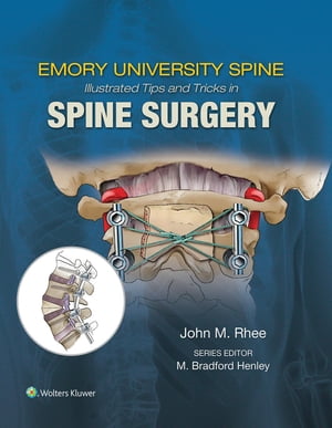 楽天Kobo電子書籍ストア: Emory's Illustrated Tips and Tricks in Spine Surgery ...